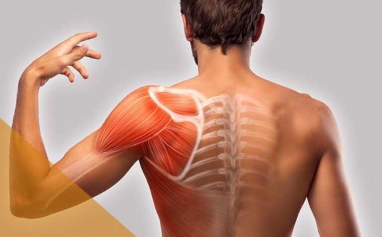 Unraveling the Mystery: Muscle Inflammation, Muscle Abscess – Causes ...